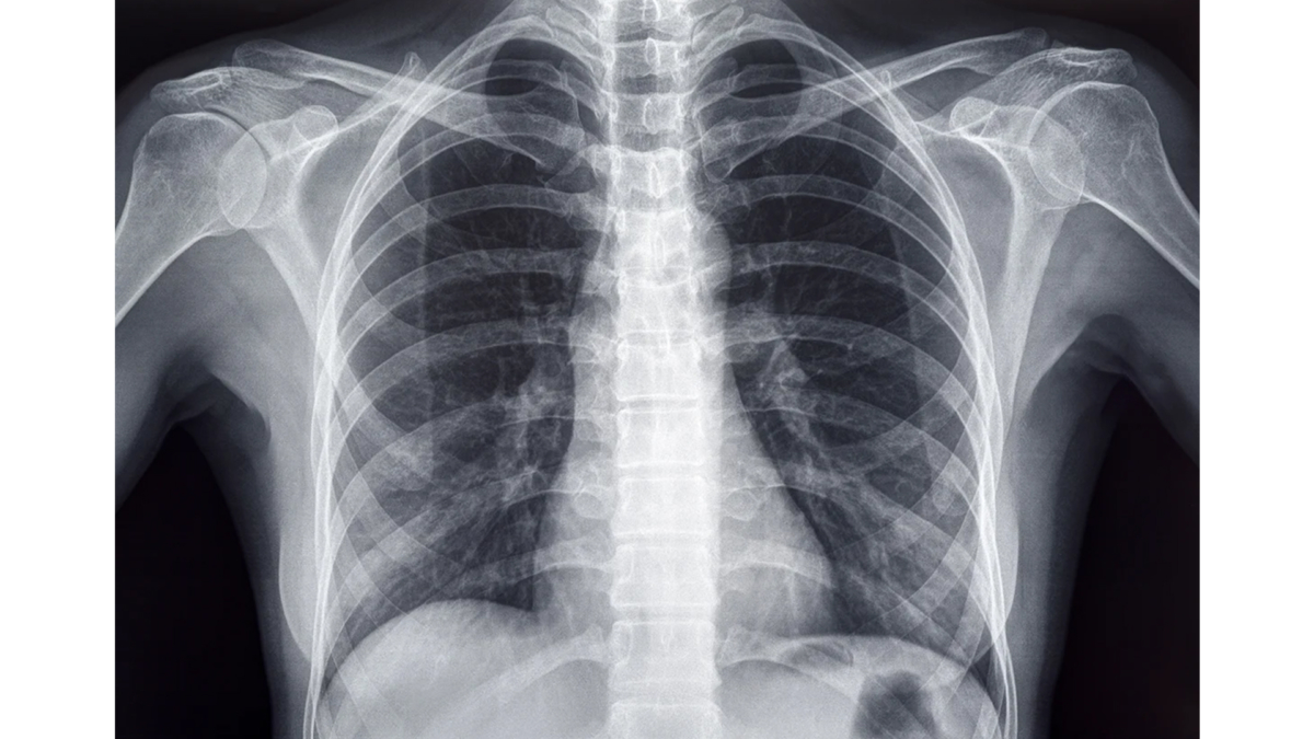 Der Arcoma Precision i5: ergonomisches Design mit hoher Bildqualität